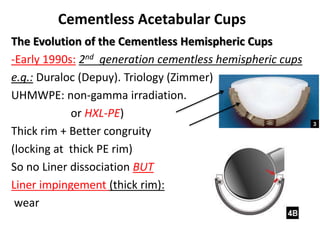 Cementless acetabular cups | PPTX