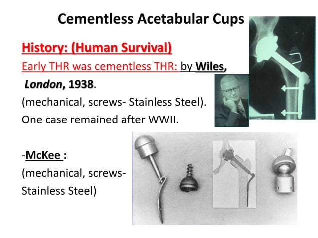 Cementless acetabular cups | PPTX | Bone and Joint Conditions ...