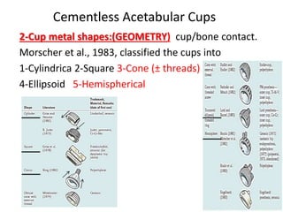 Cementless acetabular cups | PPTX