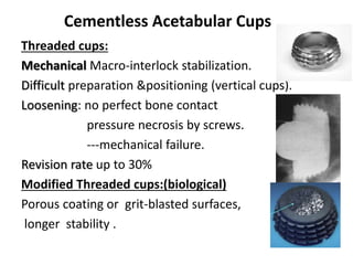 Cementless acetabular cups | PPTX