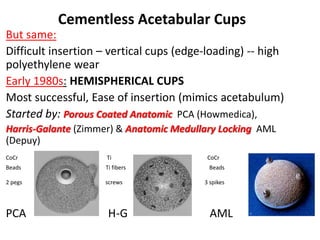 Cementless acetabular cups | PPTX