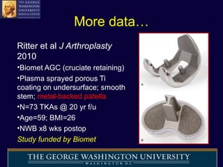 Cementless TKA | PPT