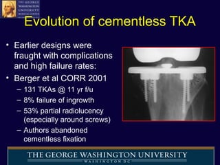 Cementless TKA | PPT