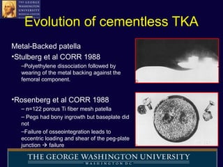 Cementless TKA | PPT