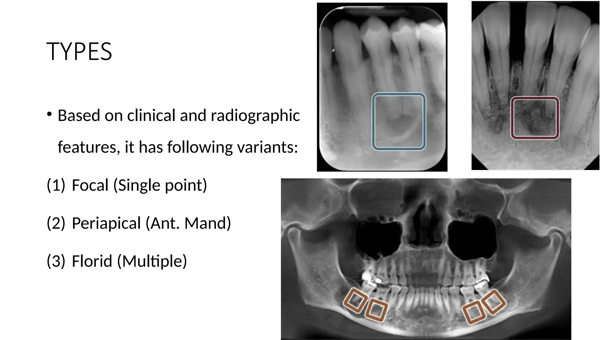 CEMENTO-OSSEOUS DYSPLASIAS power point for students | PPTX