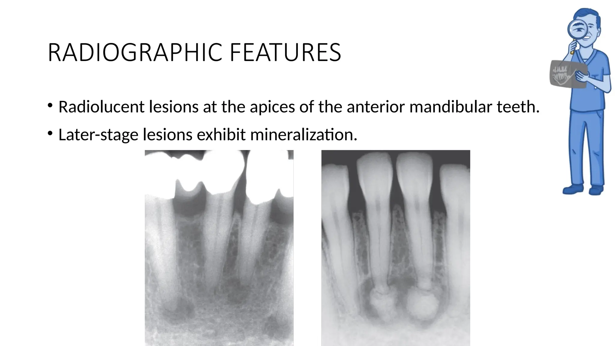 CEMENTO-OSSEOUS DYSPLASIAS power point for students | PPTX