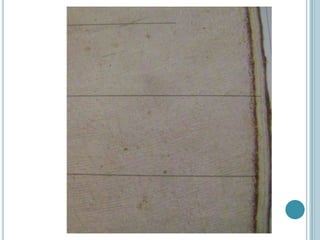 Cementogenesis | PPTX | Dental Health | Diseases and Conditions