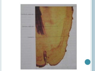 Cementogenesis | PPTX | Dental Health | Diseases and Conditions