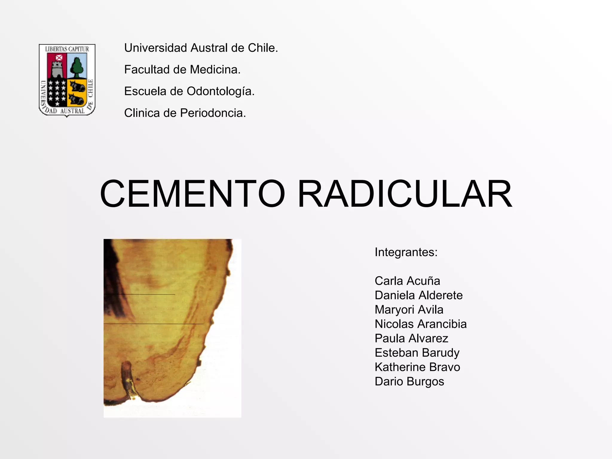 Cemento Radicular | PPT