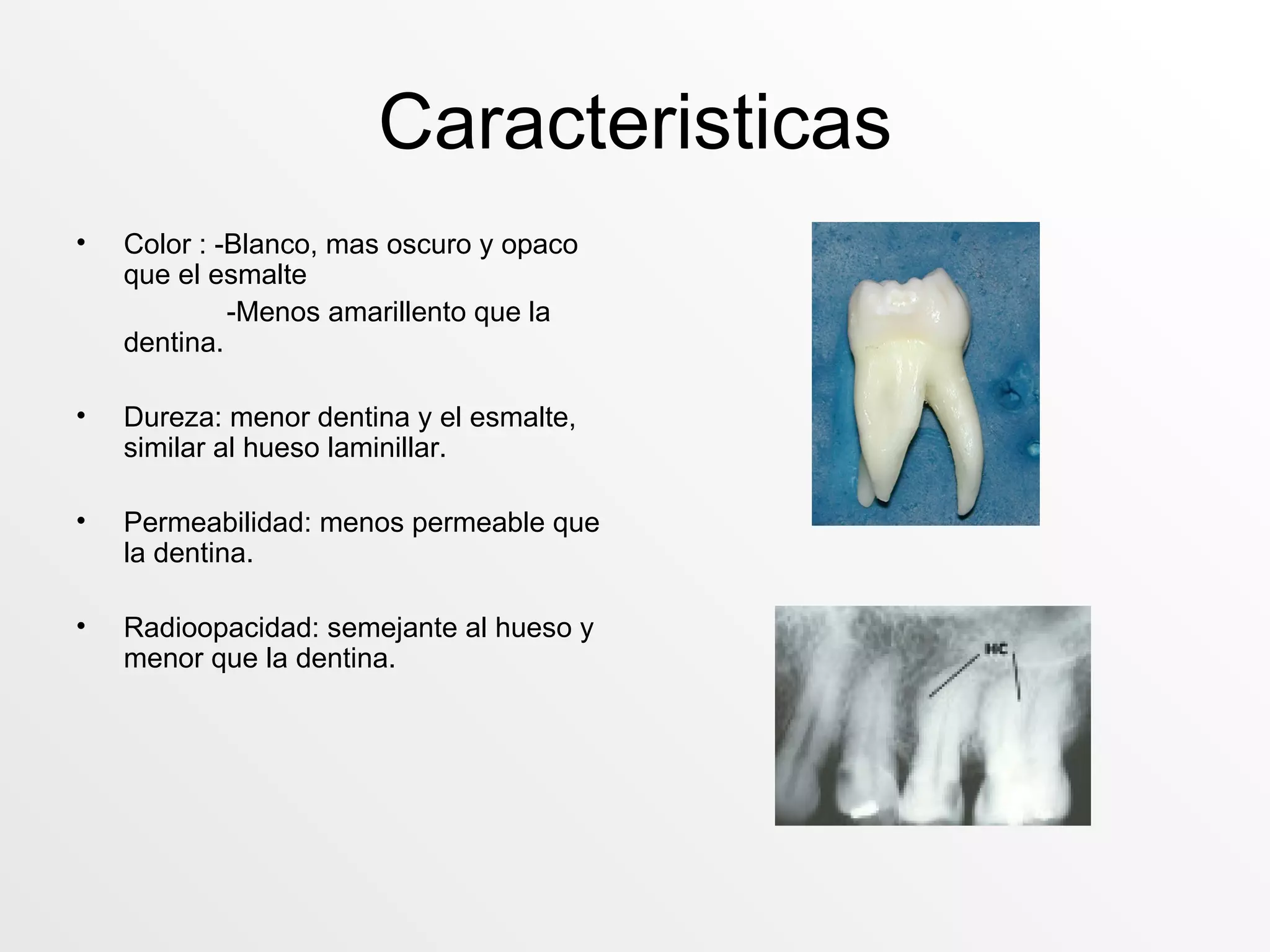 Cemento Radicular | PPT | Dental Health | Diseases and Conditions