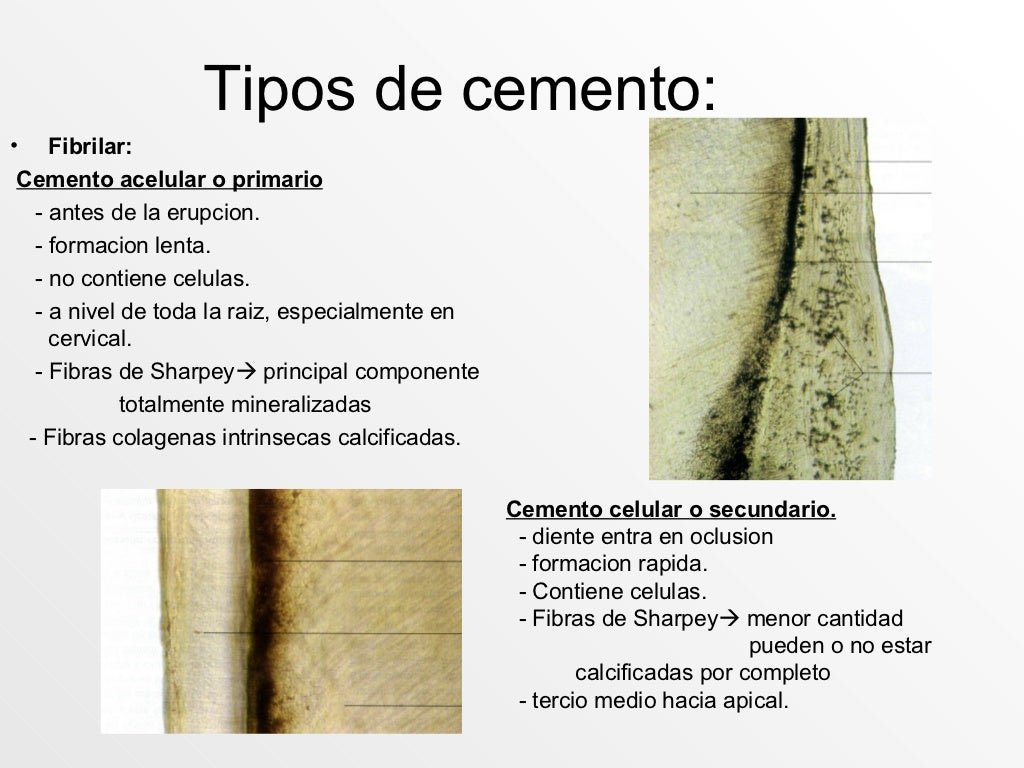 Cemento Radicular