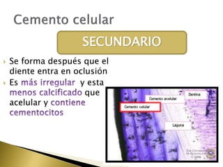 Cemento radicular | PPTX