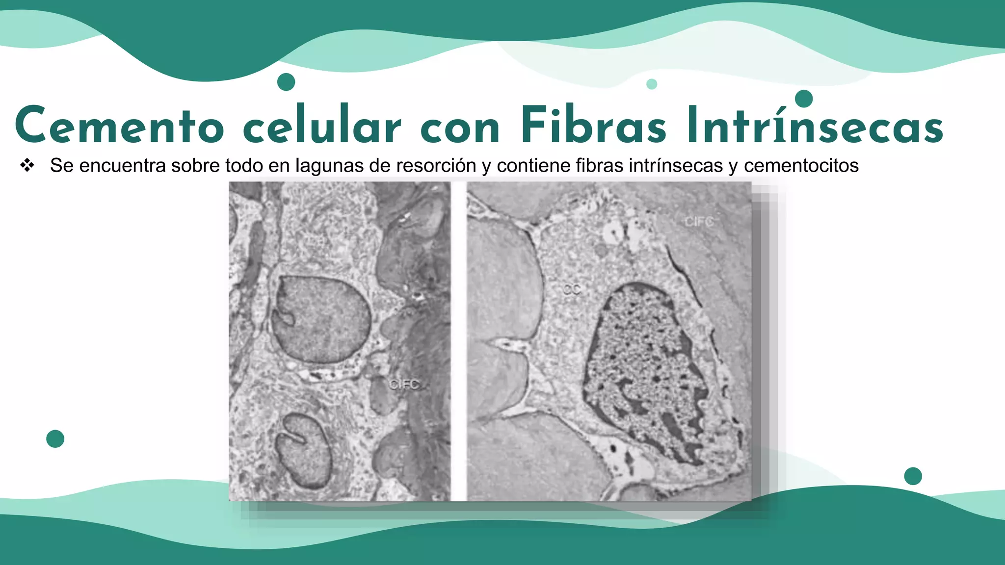 cemento radicular.pptx