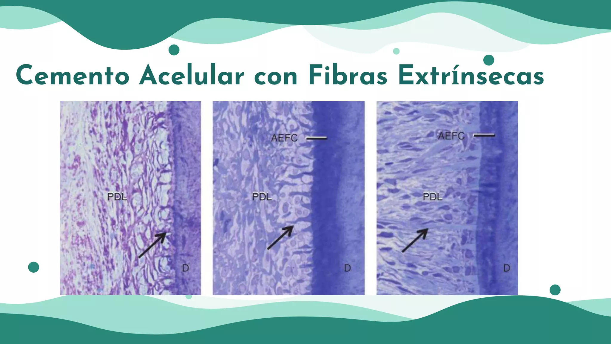 cemento radicular.pptx