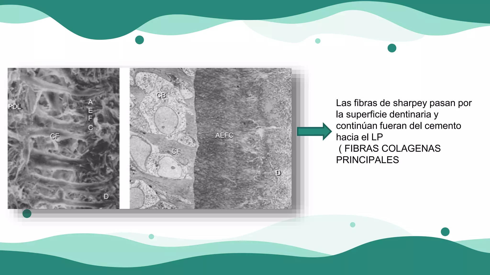 cemento radicular.pptx