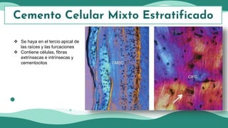 cemento radicular.pptx