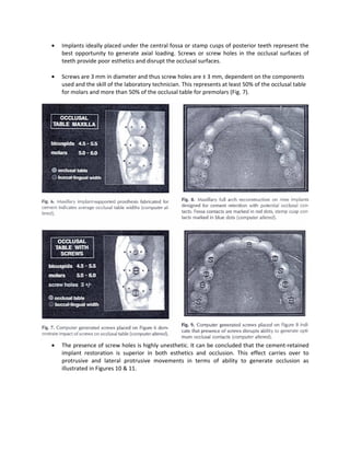 Cement Retained Versus Screw Retained Implant Restorations Achieving ...