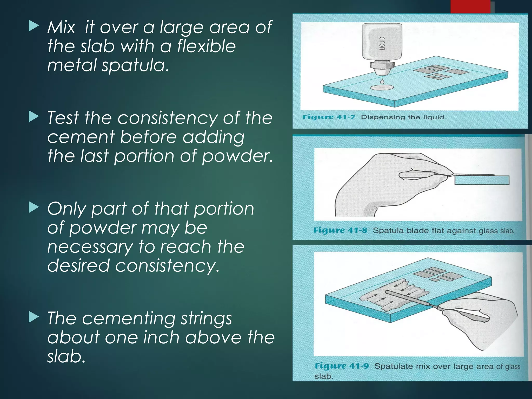 dental cements | PPT