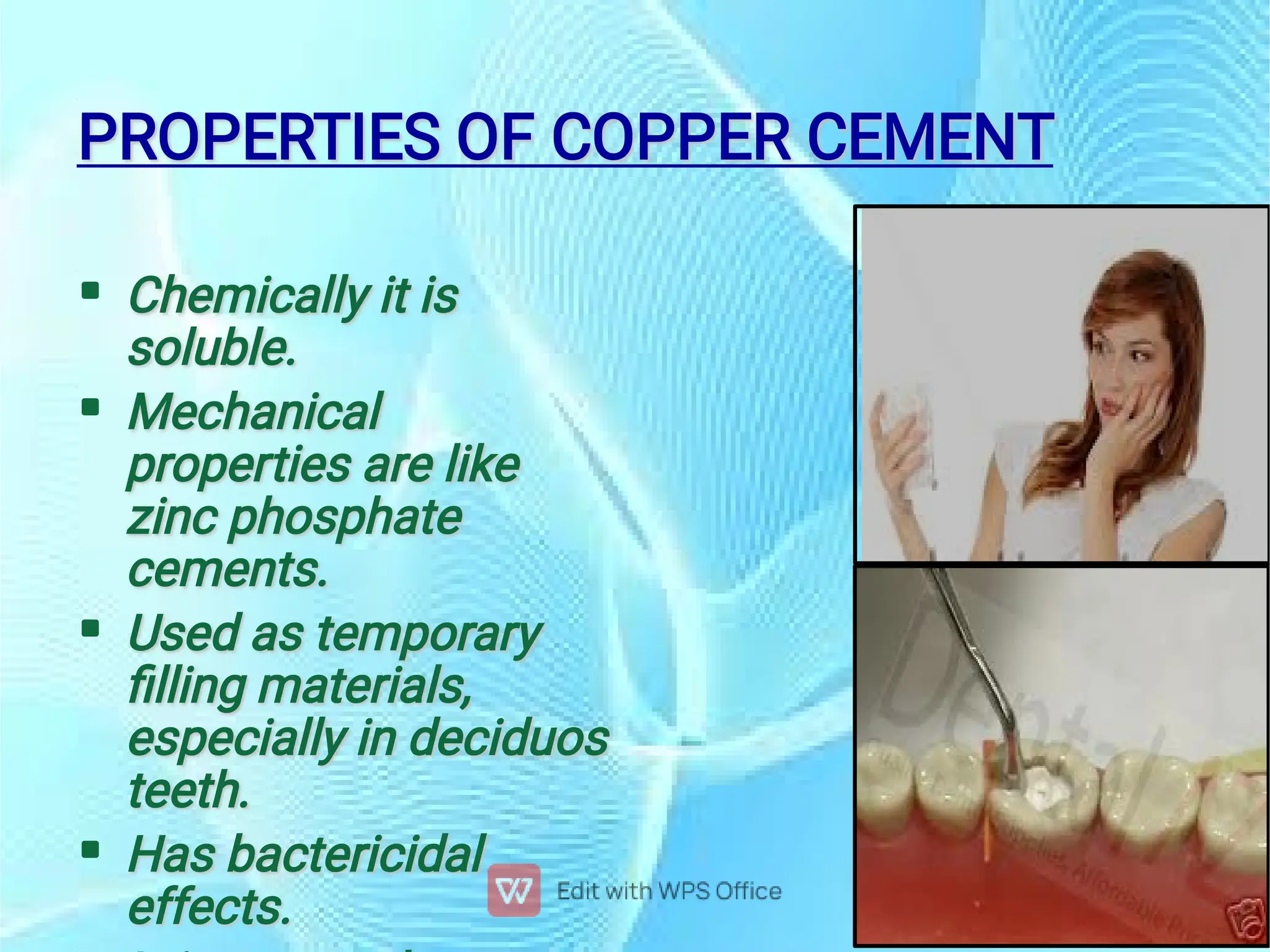 DENTAL CEMENTS Dental Material by Dr. pdf | PPT