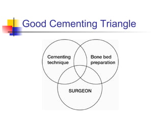 Cementing Technique in Arthroplasty - tips, tricks and Traps | PPT