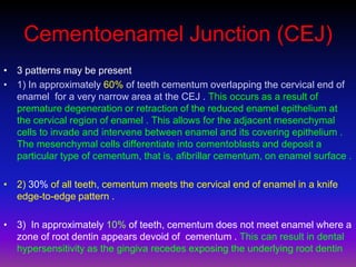 Cementoenamel Junction