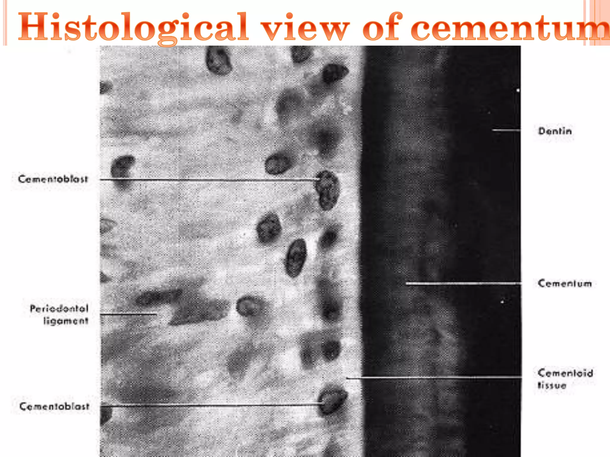 Cementum | PPT