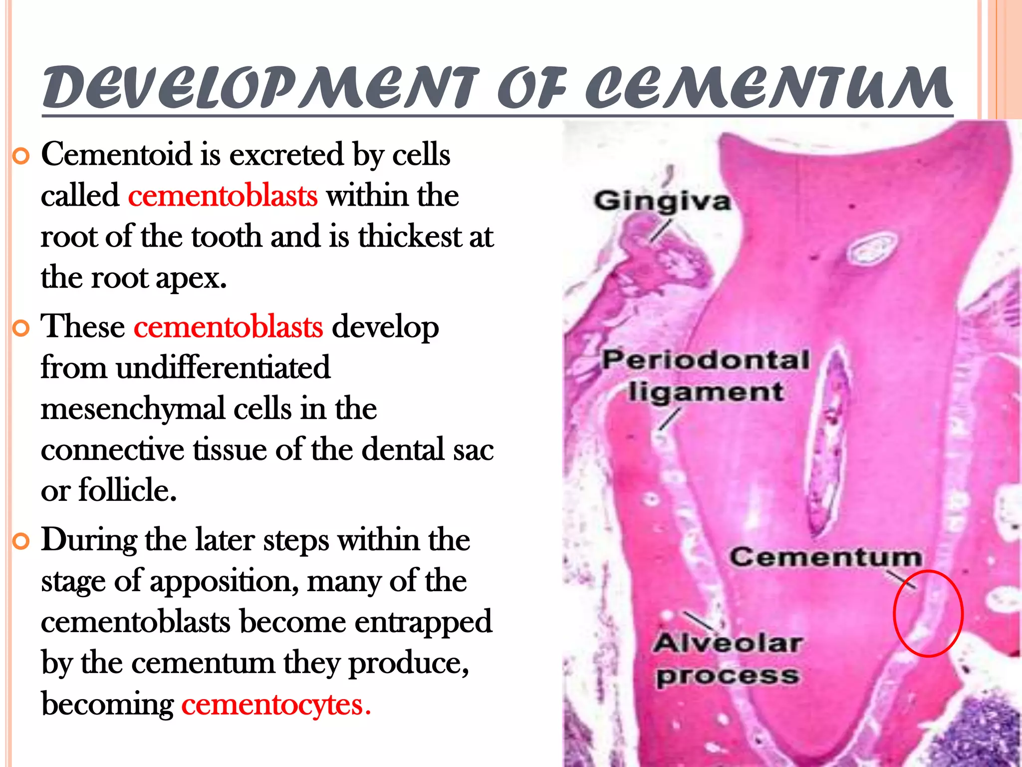 Cementum | PPT