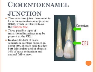 Cementum | PPT