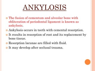 Cementum | PPTX