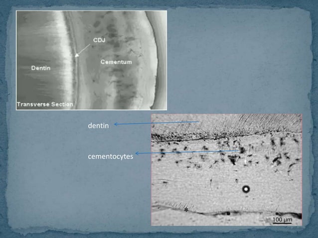 Cementum | PPTX | Dental Health | Diseases and Conditions