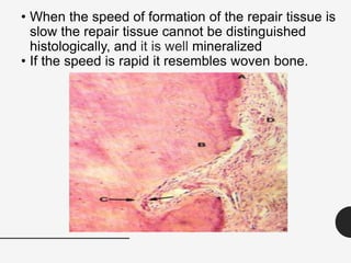 Oral Histology - Cementum | PPTX