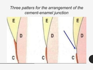 Oral Histology - Cementum | PPTX