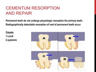 Cementum | PPT