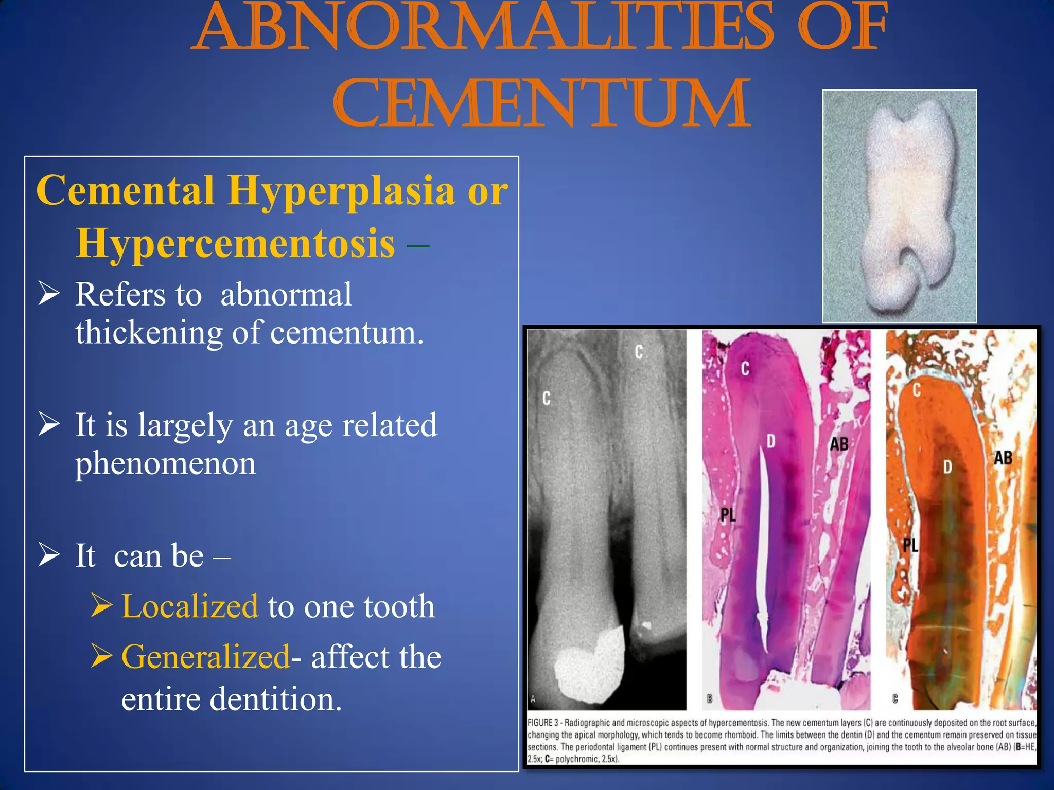 Cementum | PDF