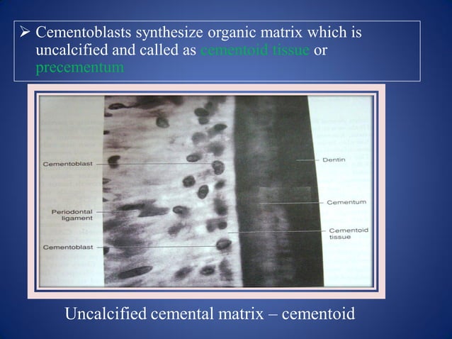 Cementum | PDF | Dental Health | Diseases and Conditions