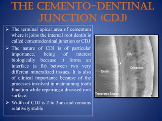 Cementum | PPT