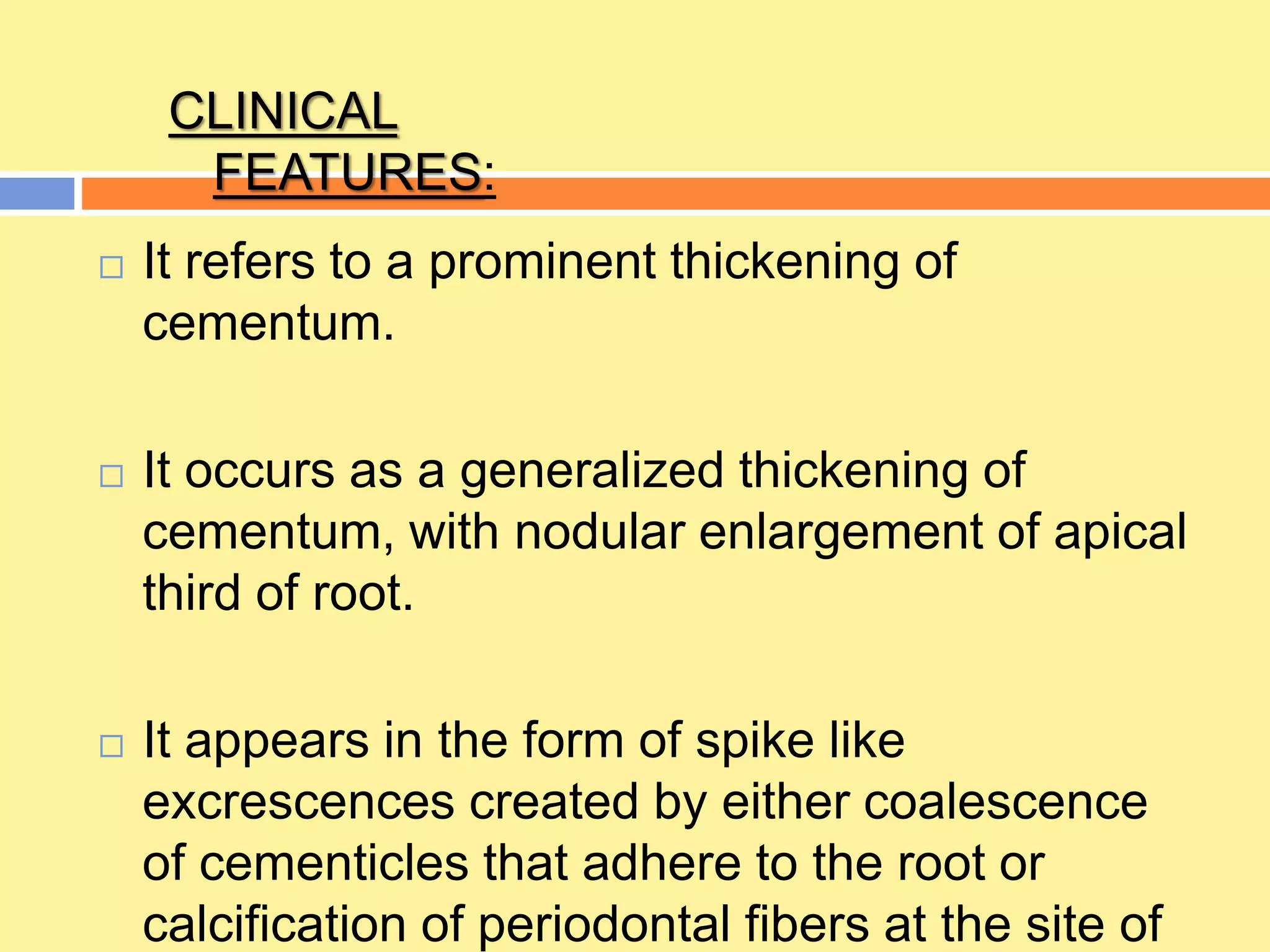 Cementum | PPTX