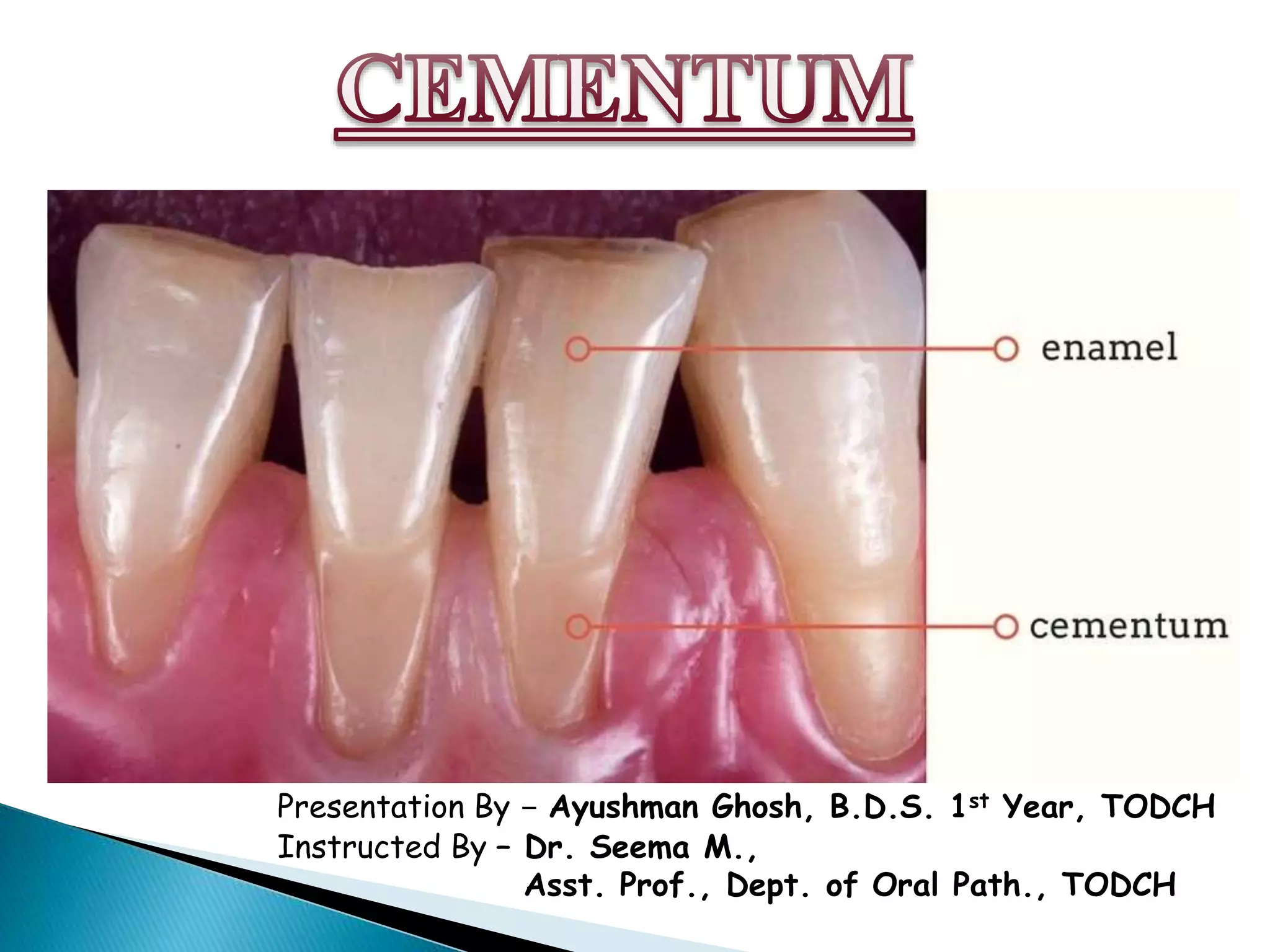Understanding Cementum: Its Formation, Types and Functions | PPT