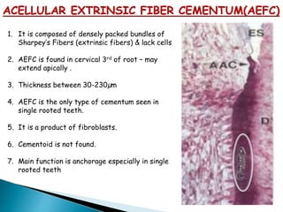 Cementum | PPT
