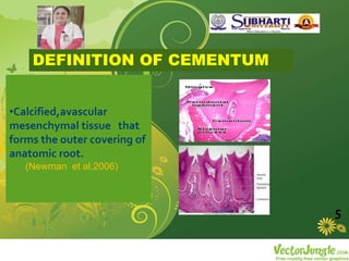 Cementum-20207231215390.ppt