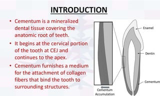 Cementum | PPT