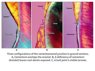 Cementum and its development | PPTX