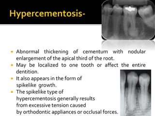 Cementum and its development | PPTX