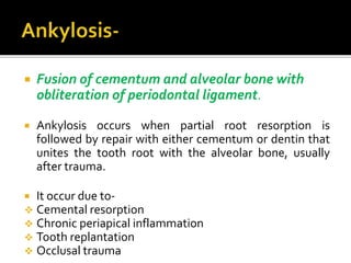 Cementum and its development | PPTX