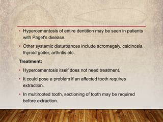 CEMENTUM | PPTX