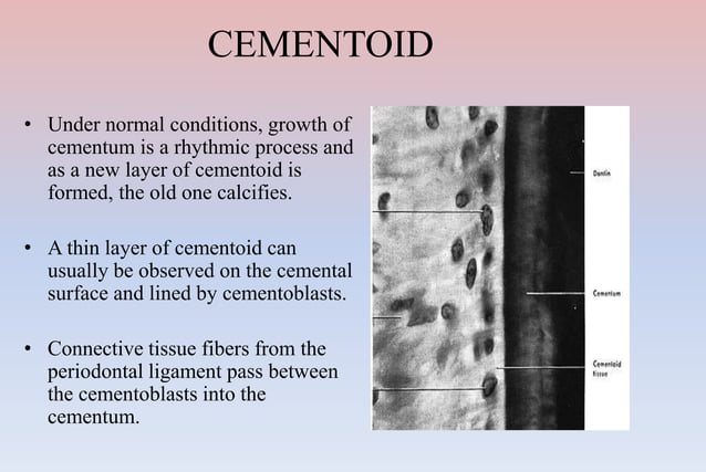 Cementum | PPT