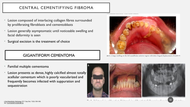 CEMENTUM clinical significance and clinical significance | PPTX | Dental Health | Diseases and ...