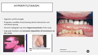 CEMENTUM clinical significance and clinical significance | PPTX