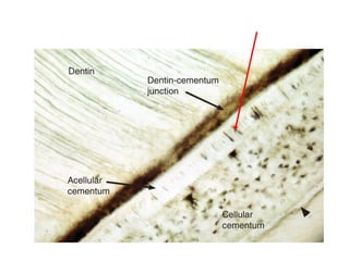 cementum detailed histology and types .pdf