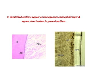 cementum detailed histology and types .pdf